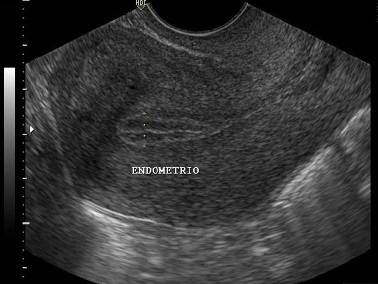 Ultrassom Ginecológico | Diagnosis Centro de Diagnóstico por Imagem ...